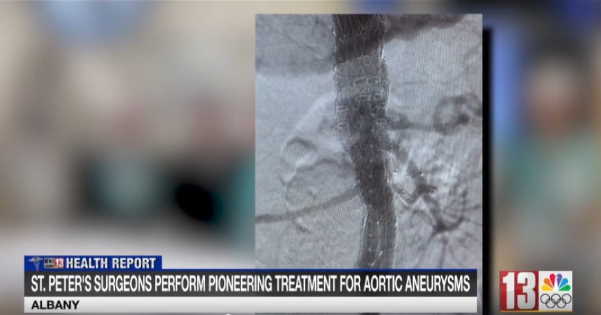 WNYT: St. Peter's Surgeons Perform New Procedure to Treat Aortic ...